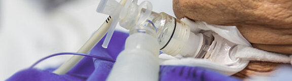 Außerklinische Intensivpflege: AOK Gesundheitspartner