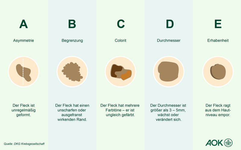 Vorstufe Weisser Hautkrebs