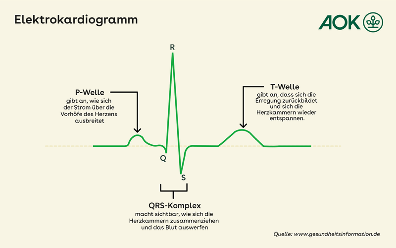 EKG: Das sagen die Ergebnisse aus