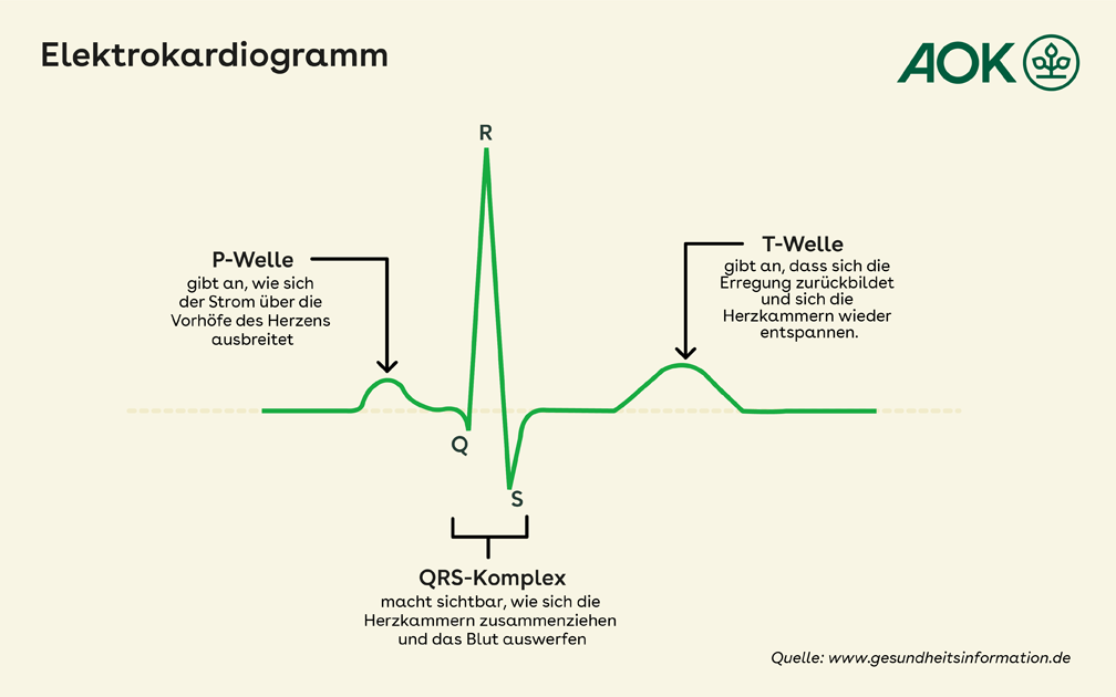 Wie Liest Man Das Ekg Wie Kann Ich Ein Elektrokardiogramm